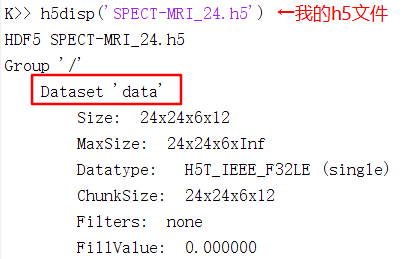 利用matlab展示并读取.h5文件内容_matlab读取h5文件-CSDN博客