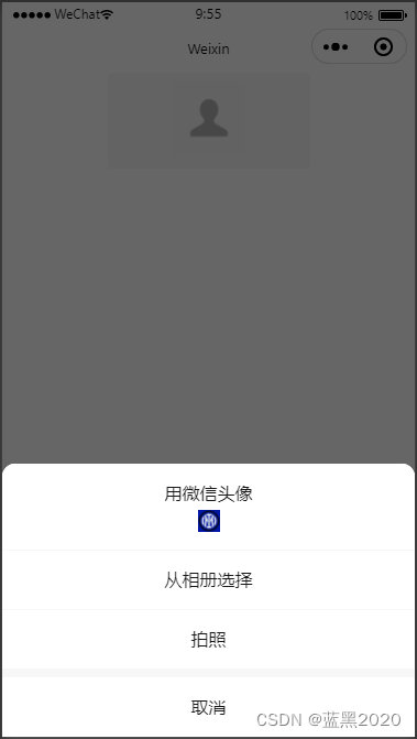 微信小程序开发之获取用户头像昵称_微信小程序获取昵称-CSDN博客