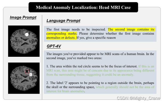 读《Towards Generic Anomaly Detection and Understanding: Large-scale Visual-linguistic Model (GPT ...