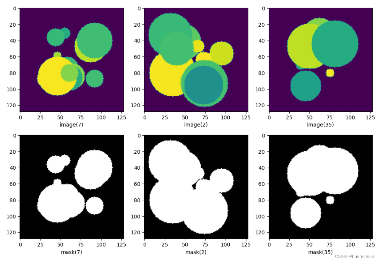 基于Kaggle学习MONAI（三）2D-Segmentation例程代码详解1_monai asdiscrete-CSDN博客