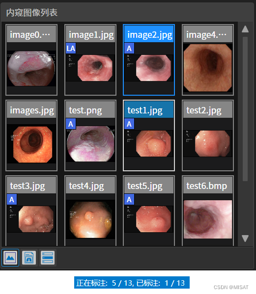 MISAT医学图像分割与标注软件套装专业版正式上线-CSDN博客