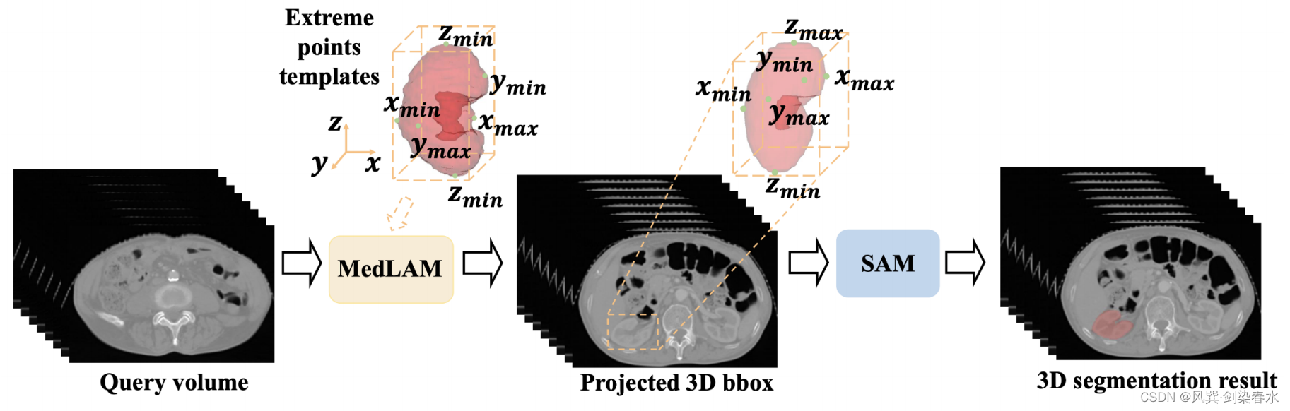 【SAM综述】医学图像分割的分割一切模型：当前应用和未来方向_segment anything model for medical image segmentat-CSDN博客