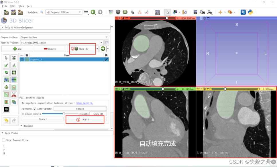 【3D Slicer】心脏CT图像分割操作保姆级教程 Cardiac CT image segmentation_3dslice 分割使用教程-CSDN博客