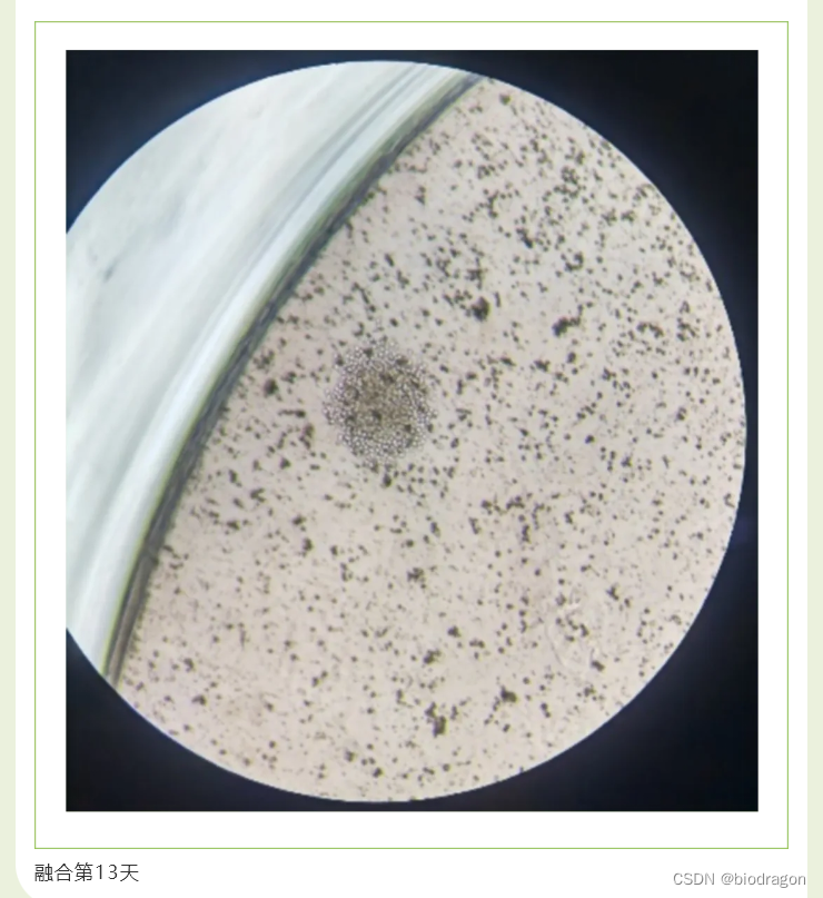 博奥龙HT/HAT选择性培养基，您的信任之选_ht培养基博奥龙-CSDN博客