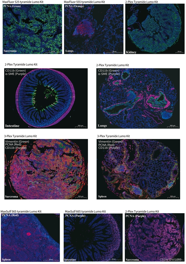 酪酰胺信号放大（TSA）技术简介_tsa信号放大-CSDN博客