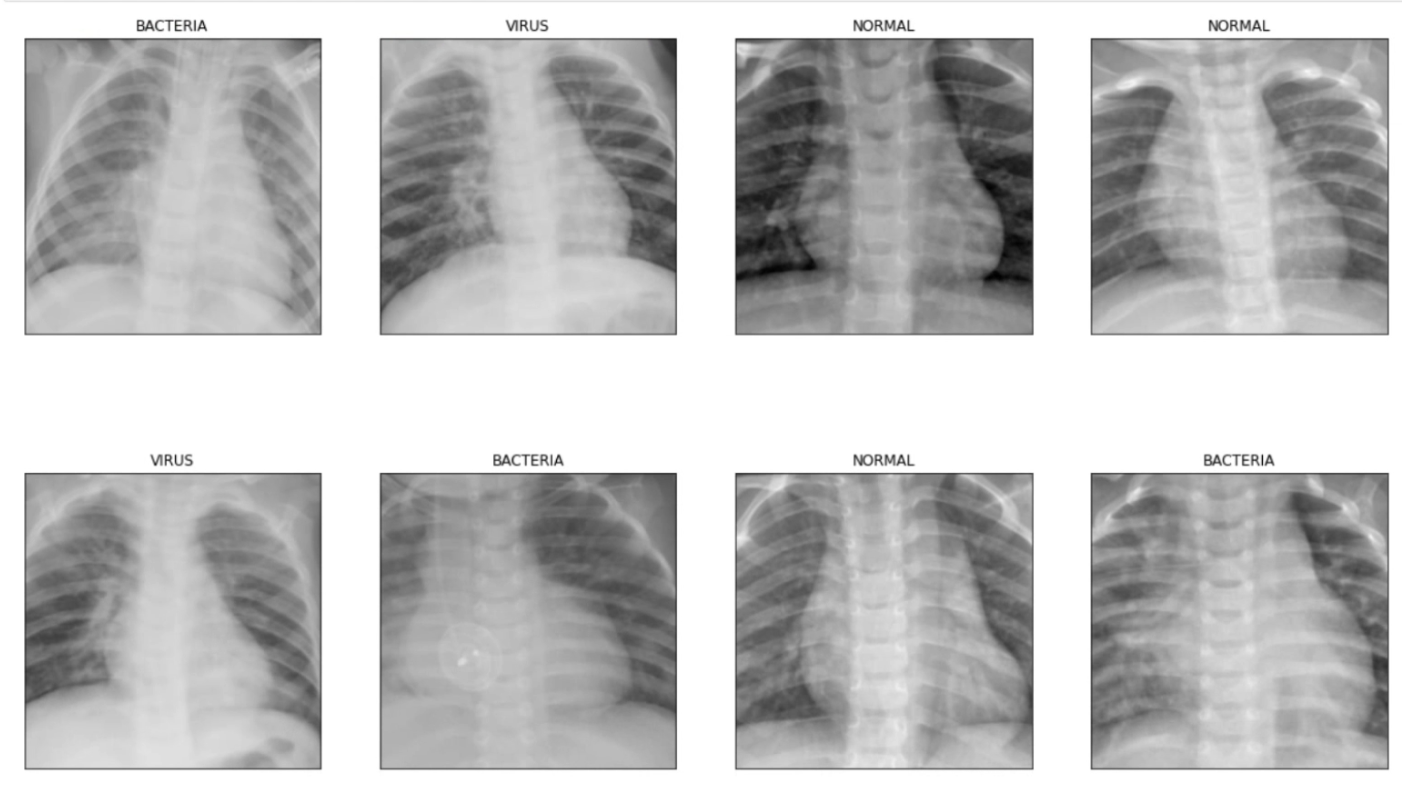 Python基于改进Resnet和Vgg新冠肺炎分类[源码＆部署教程]_vgg的改进-CSDN博客