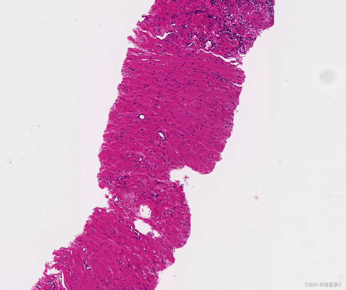 病理图片svs格式在web上的呈现--python方案_svs病理文件如何打开-CSDN博客