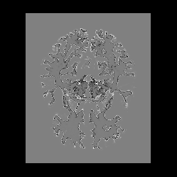 关于python处理BrainWeb下载的文件_brainweb数据集用什么软件处理数据-CSDN博客