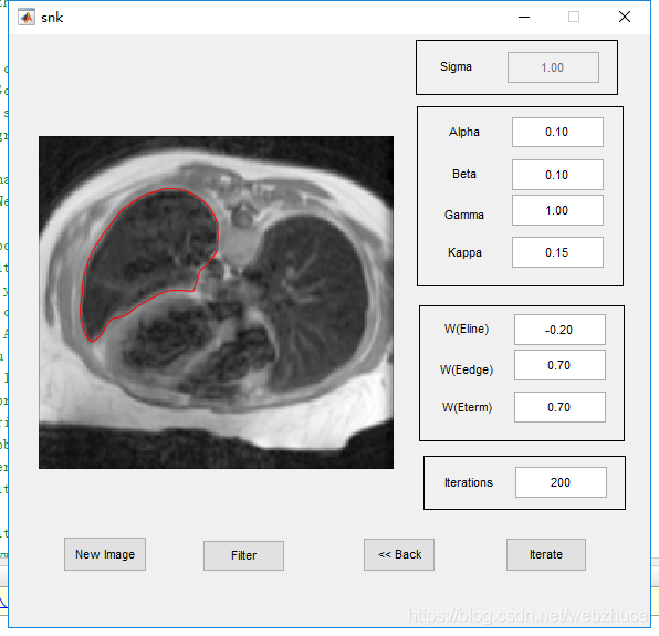 图像分割之Snake主动轮廓模型(Matlab代码)_主动轮廓模型 snake算法matlab代码-CSDN博客