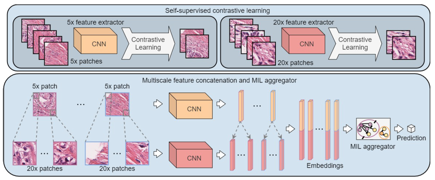论文阅读 (60)：Dual-stream Multiple Instance Learning Network for Whole Slide Image Classification ...