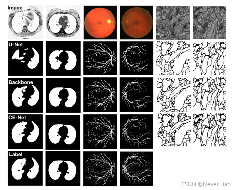 CE-Net: Context Encoder Network for 2D Medical Image Segmentation_gu 等人于2019年提出一种上下文编码网络ce-net ...