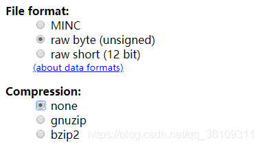 BrainWeb: Simulated Brain Database使用（原图以及GroundTruth切片可视化）和矢状冠状横断面-CSDN博客