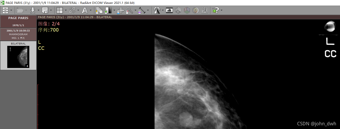 RadiAnt DICOM Viewer 2021.1中文版_radiant dicom viewer 汉化-CSDN博客