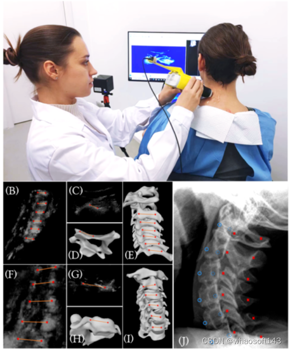 HACK-Model-CSDN博客