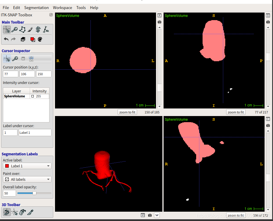 Study-VTK：将三维模型转为二维切片 stl/vtp to dcm/vti_vtkimagestencil-CSDN博客