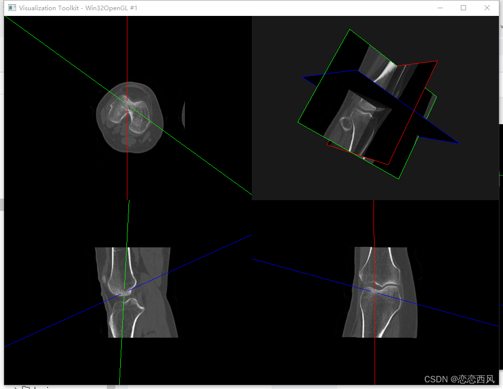 三维重建 Pyqt Python Mpr 四视图(横断面,冠状面,矢状面,3d)vtkreslicecursorlinerepresentation和vtkreslicecurso Csdn博客