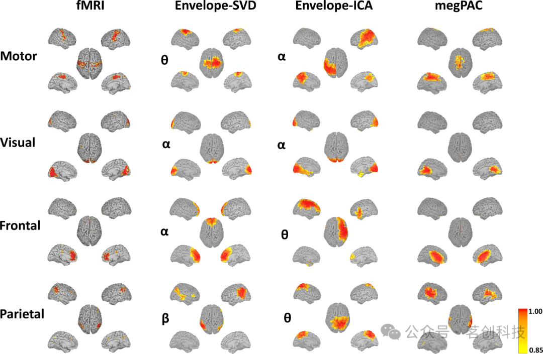 利用数据驱动的MEG分析方法提取fMRI静息态网络_基于meg的特征提取-CSDN博客