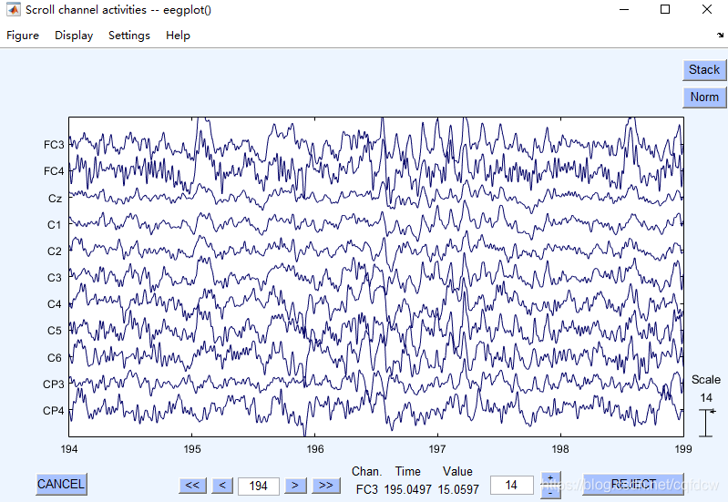 针对Matlab脑电数据EEG处理、 eeglab工具箱、Neuracle数据采集操作要点事项_博瑞康脑电采集教程-CSDN博客