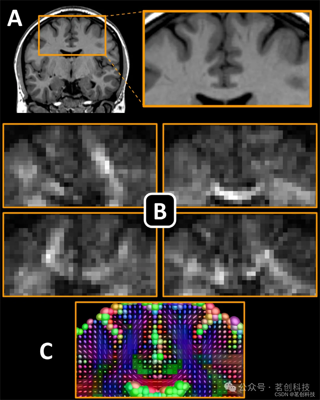 基于扩散MRI的连接_dmri-CSDN博客