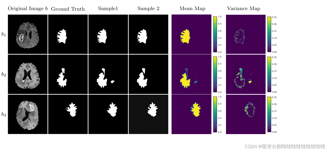 Diffusion Models for Implicit Image Segmentation Ensembles-CSDN博客