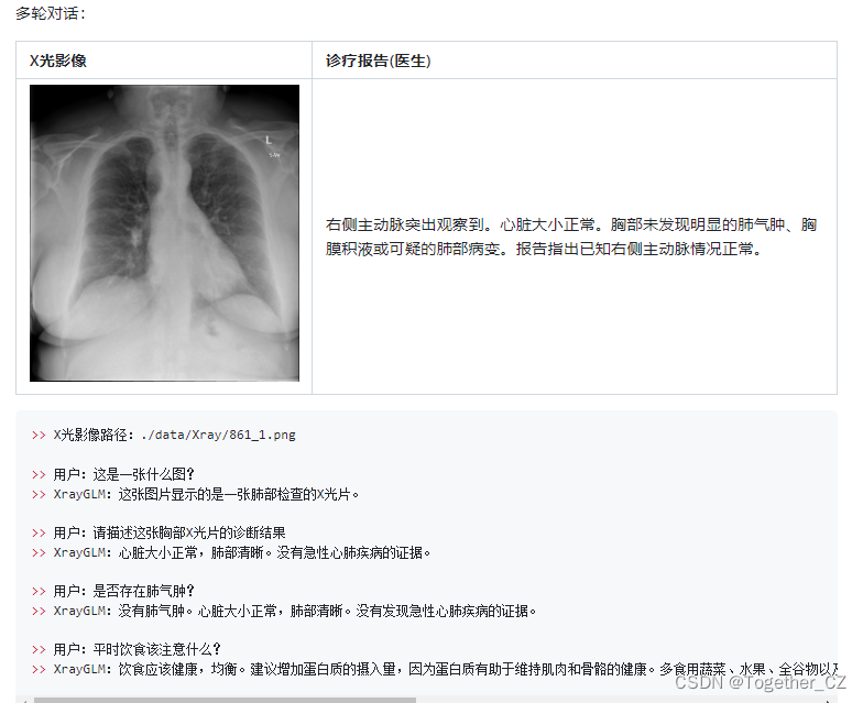《XrayGLM：基于VisualGLM-6B微调训练对X光胸片进行医学诊断》学习分享与本地项目微调部署实践-CSDN博客