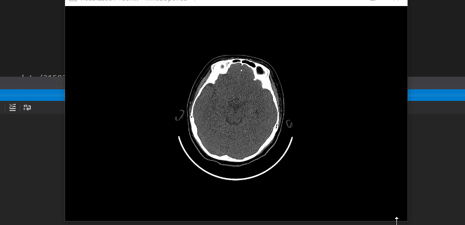 ITK、VTK 读取 DiCOM 文件信息，并实现交互预览_vtk读取dicom-CSDN博客