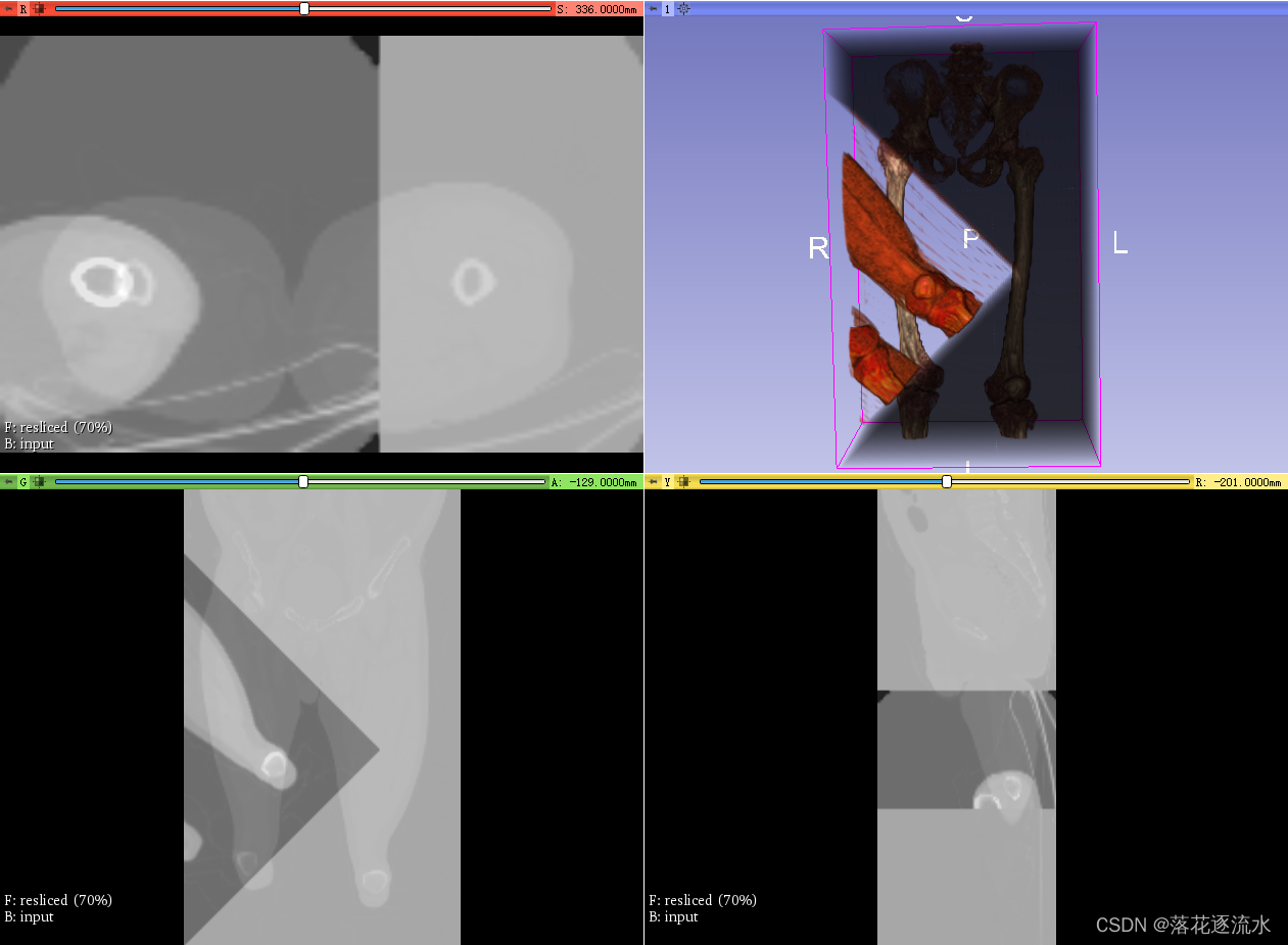 VTK学习笔记（三十九）vtkImageReslice-CSDN博客