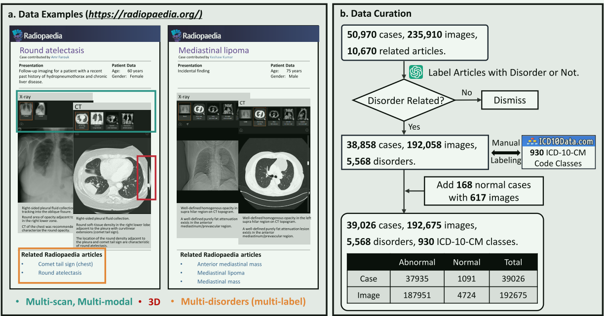 【论文阅读笔记】医学多模态新数据集-Large-scale Long-tailed Disease Diagnosis on Radiology Images-CSDN博客