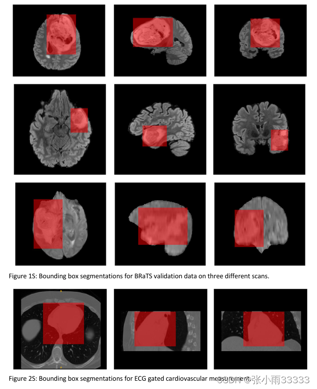 医学图像目标检测 Yolo篇：medyolo A Medical Image Object Detection Framework Csdn博客