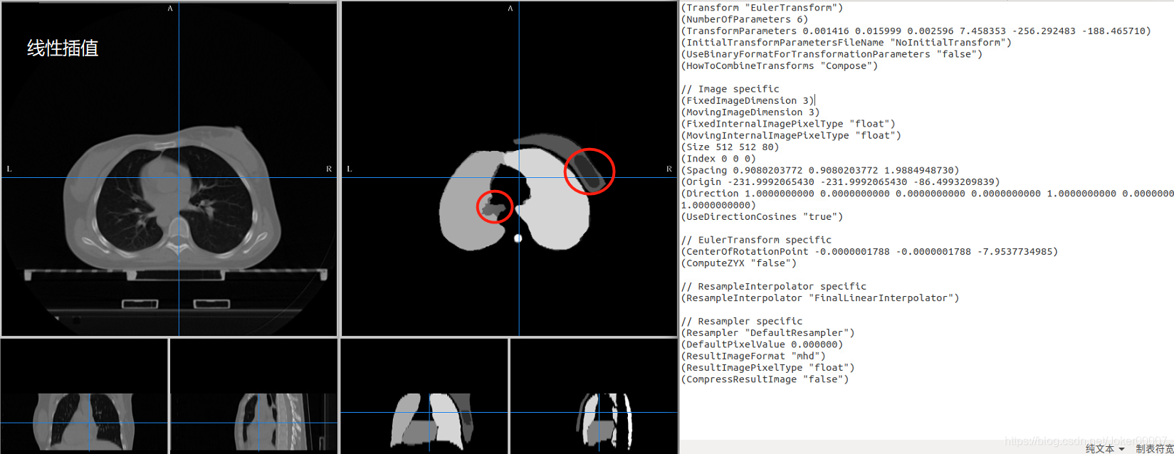 医学图像配准工具SimpleElastix和Elastix的使用——解决参数文件的重采样插值方式(ResampleInterpolator)的影响_elastix 参数文件-CSDN博客