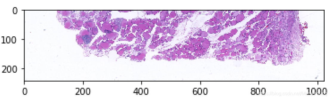 使用openslide-python对whole slide image（WSI）进行读取、显示和金字塔构建、生成tiles_wsi金字塔图 ...