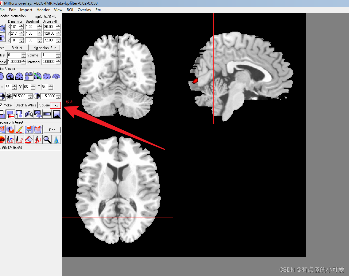 fMRI数据处理（随时更新）-CSDN博客