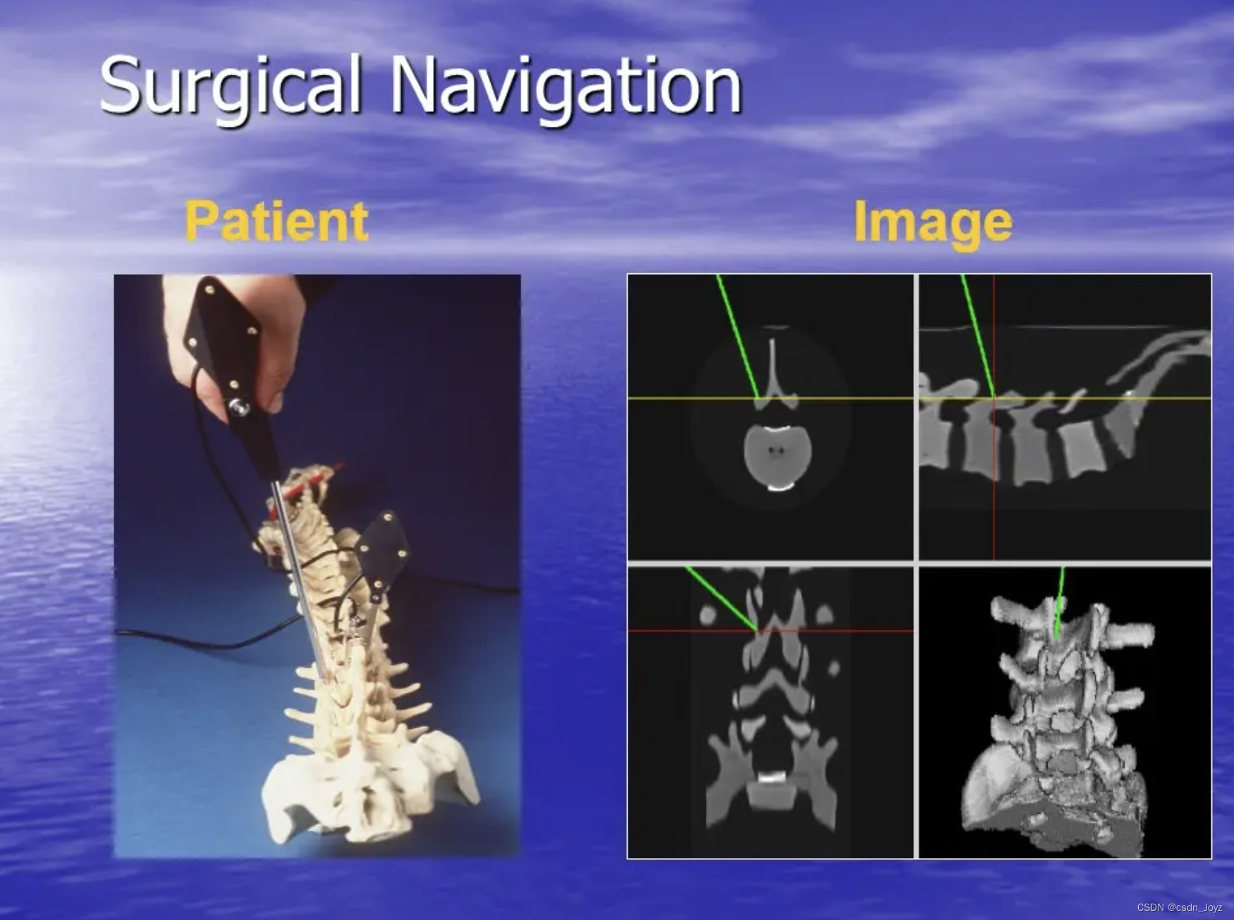 【Hololens 2】使用Unity fo-dicom实现多平面三维重建(mpr)_dicom 三维重建-CSDN博客