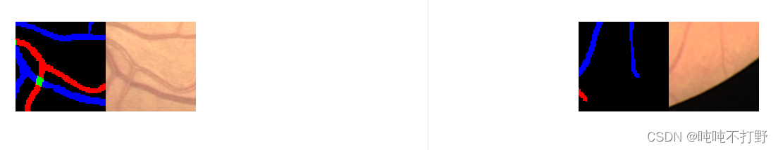 MMSegmentation——流程化使用_mmsegmention-CSDN博客