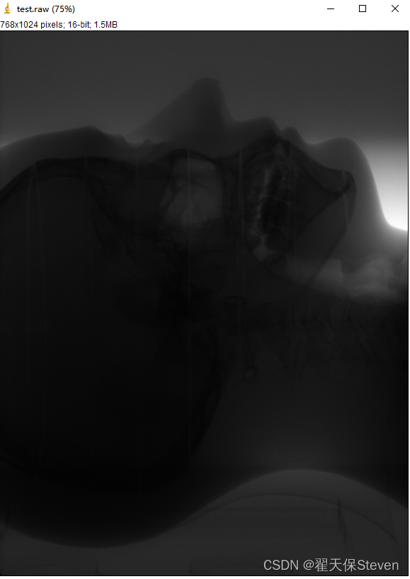 Matlab-写入mhd和raw医学图像处理格式文件_mhd文件-CSDN博客