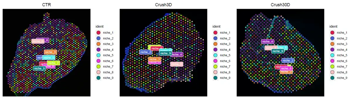 10X空间转录组数据分析之细胞niche-CSDN博客