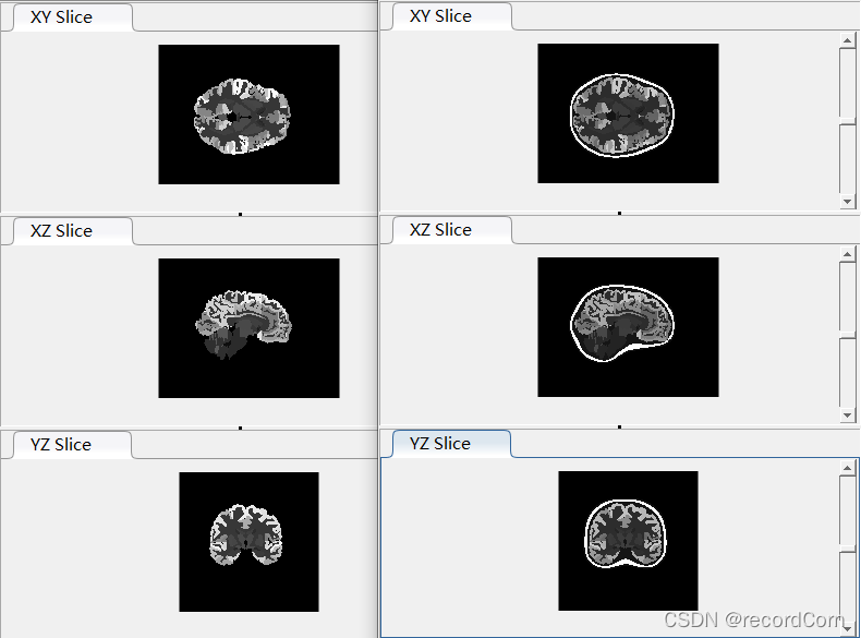 经颅聚焦超声信号仿真(MATLAB k-Wave仿真)-CSDN博客