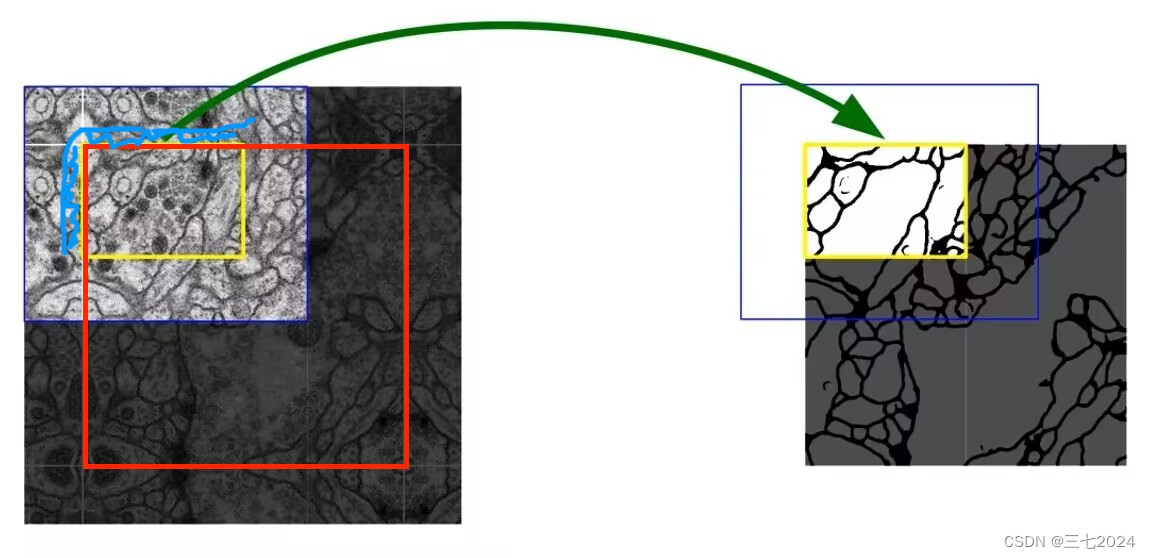 U-Net 网络结构讲解_u-net神经网络-CSDN博客