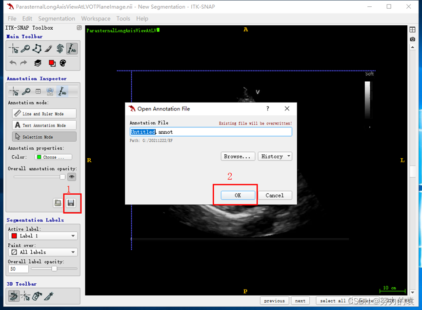 [图像分割]ITK-SNAP分割标注（点坐标）_itk-snap画直线-CSDN博客