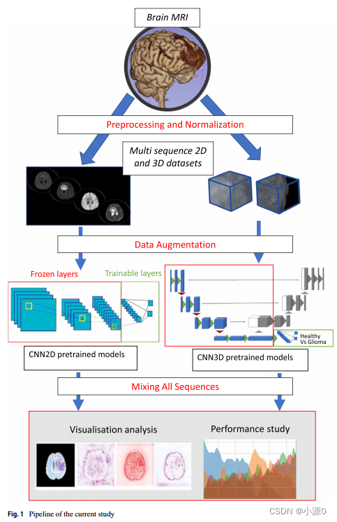 论文阅读：A multi-sequences MRI deep framework study applied to glioma ...