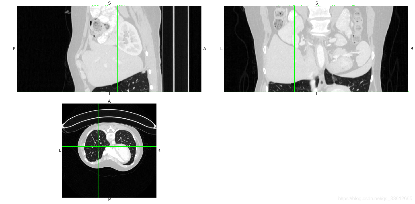 【5】nibabel三维显示_orthoslicer3d(data.transpose(1, 2, 0)).show()-CSDN博客