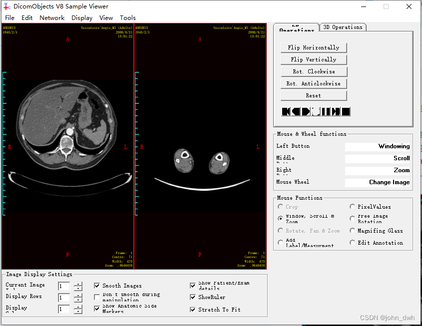 DicomObjects COM 2022-10-18-x86版本使用XP-WIN11_dicomobjects 影像组件-CSDN博客