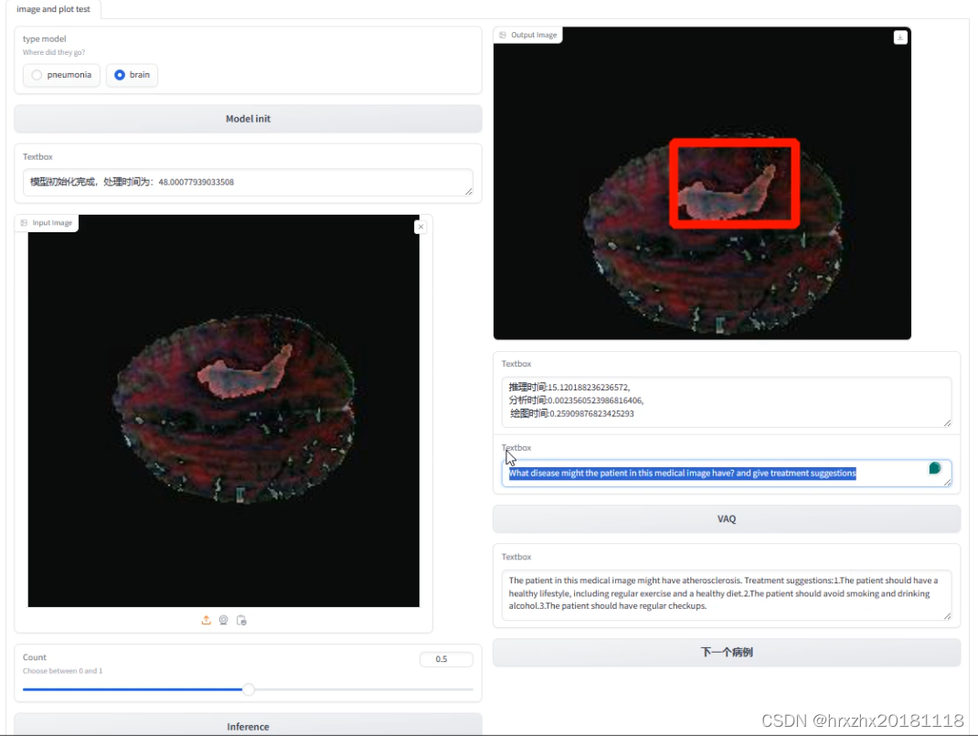 MMdetection框架下简单实现界面可视化+大模型实现本地问诊_mmdetection gradio-CSDN博客