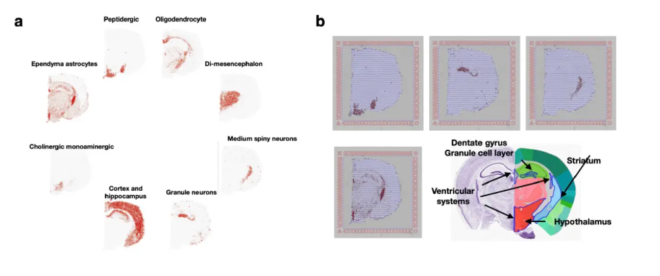 10X单细胞空间联合分析之五----spatialDWLS-CSDN博客