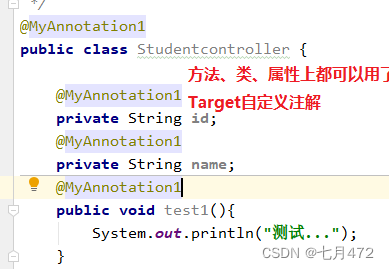 Java自定义注解详解-CSDN博客