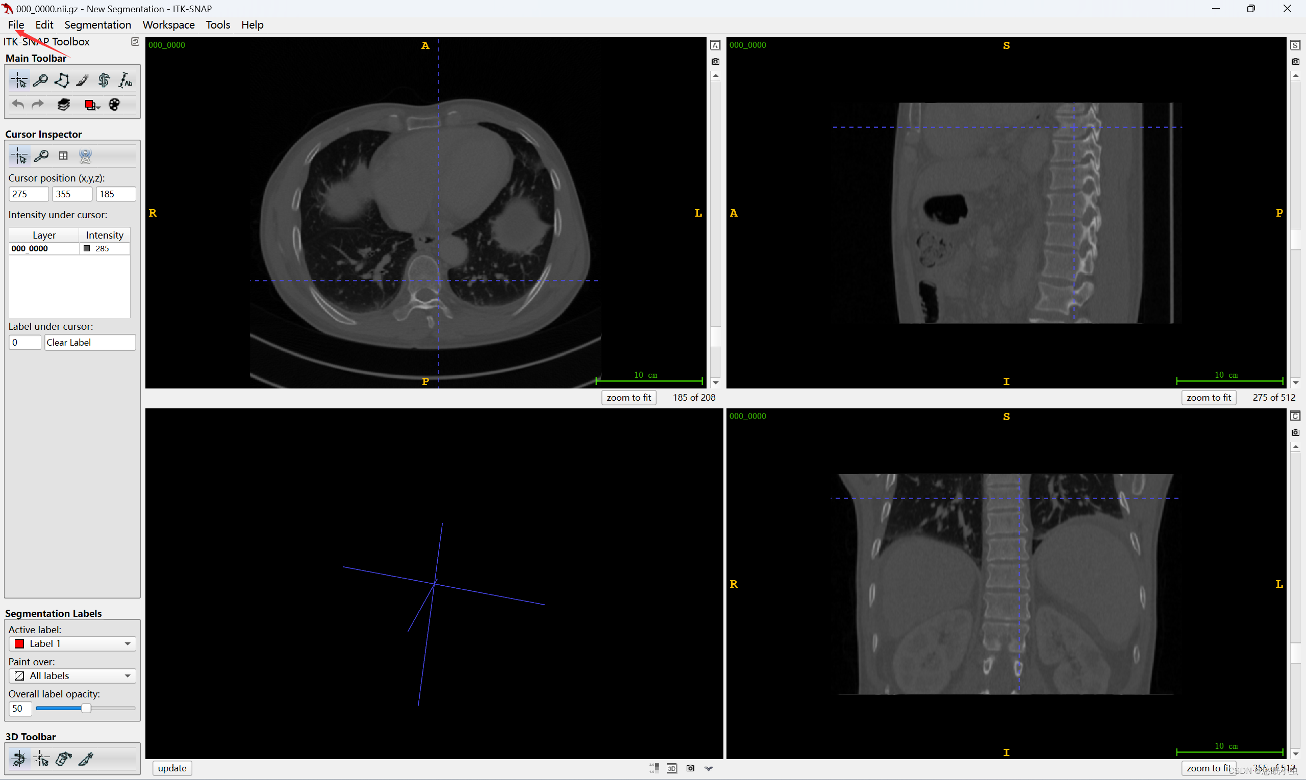 医学图像处理：nii格式转换(3D切片为2D)_.nii-CSDN博客
