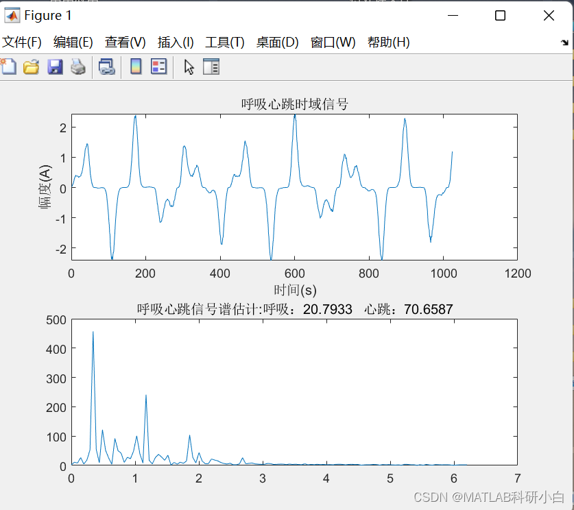 【MATLAB】FMCW毫米波雷达呼吸心跳仿真_毫米波雷达多人呼吸心跳检测matlab仿真-CSDN博客
