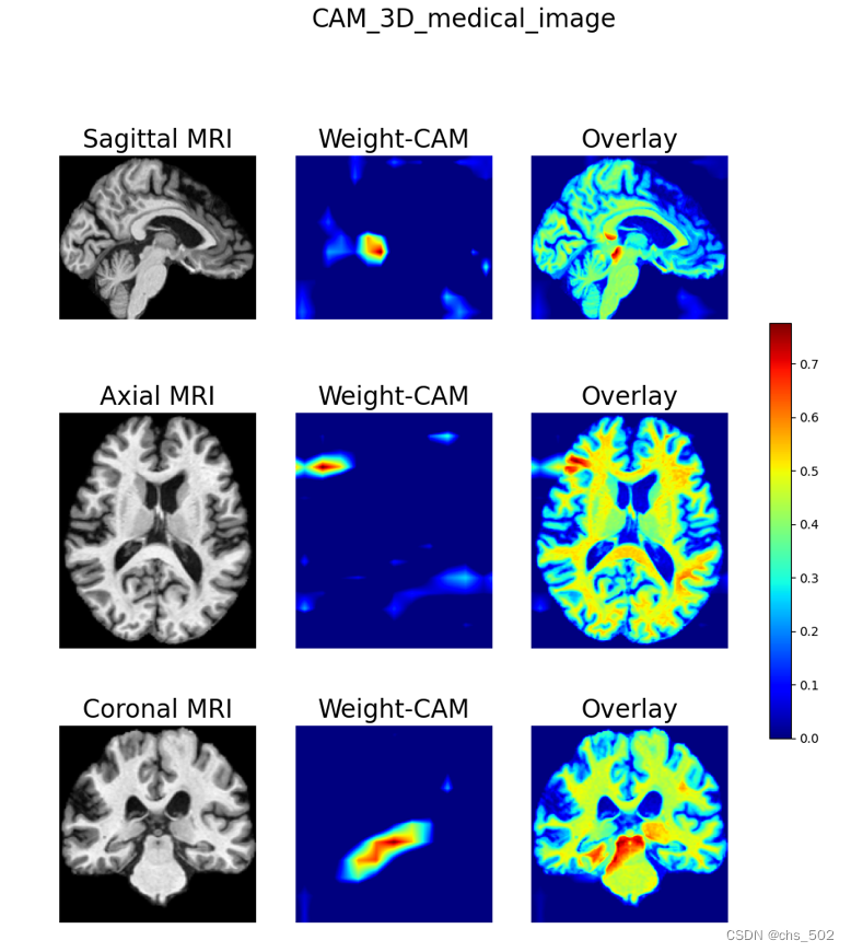 基于三维医学影像数据的CAM可视化——PyTorch实现-CSDN博客