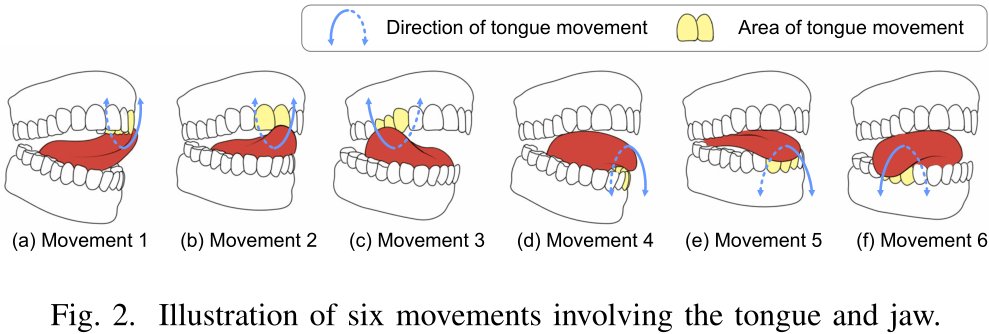 CanalScan: Tongue-Jaw Movement Recognition via Ear Canal Deformation ...
