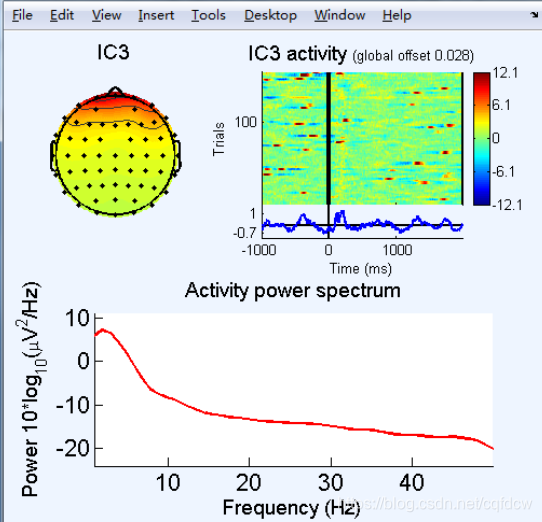 针对Matlab脑电数据EEG处理、 eeglab工具箱、Neuracle数据采集操作要点事项_博瑞康脑电采集教程-CSDN博客
